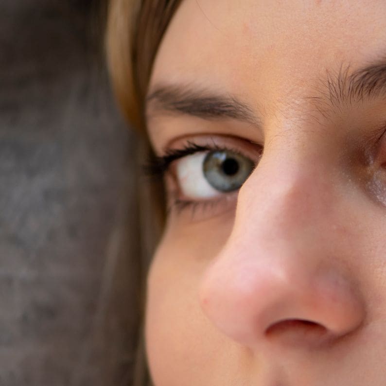 nose hump treatment | Non surgical rhinoplasty London