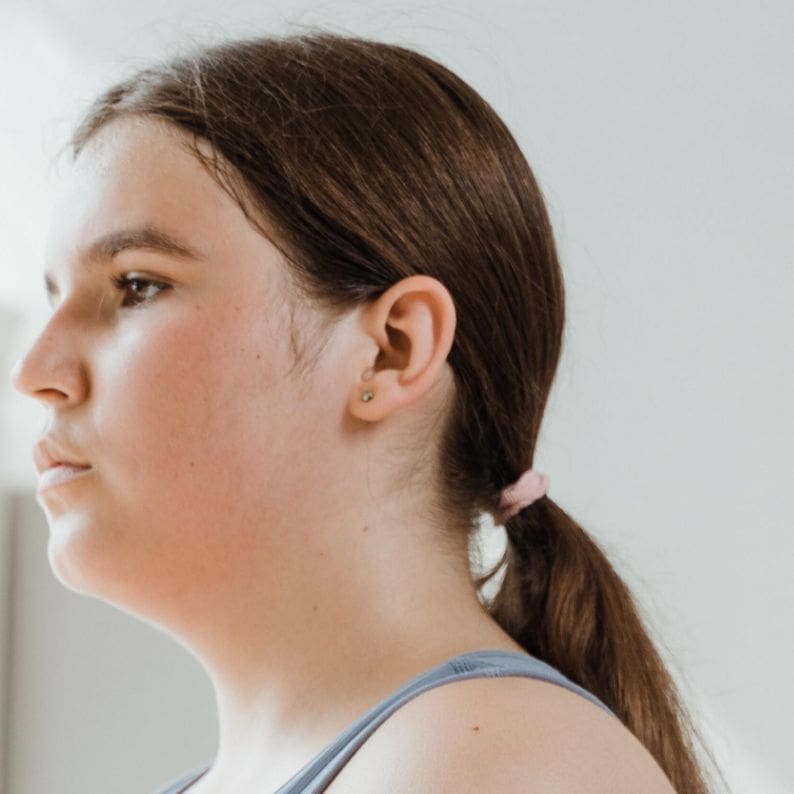 Weak Chin London | How to treat a Weak Chin