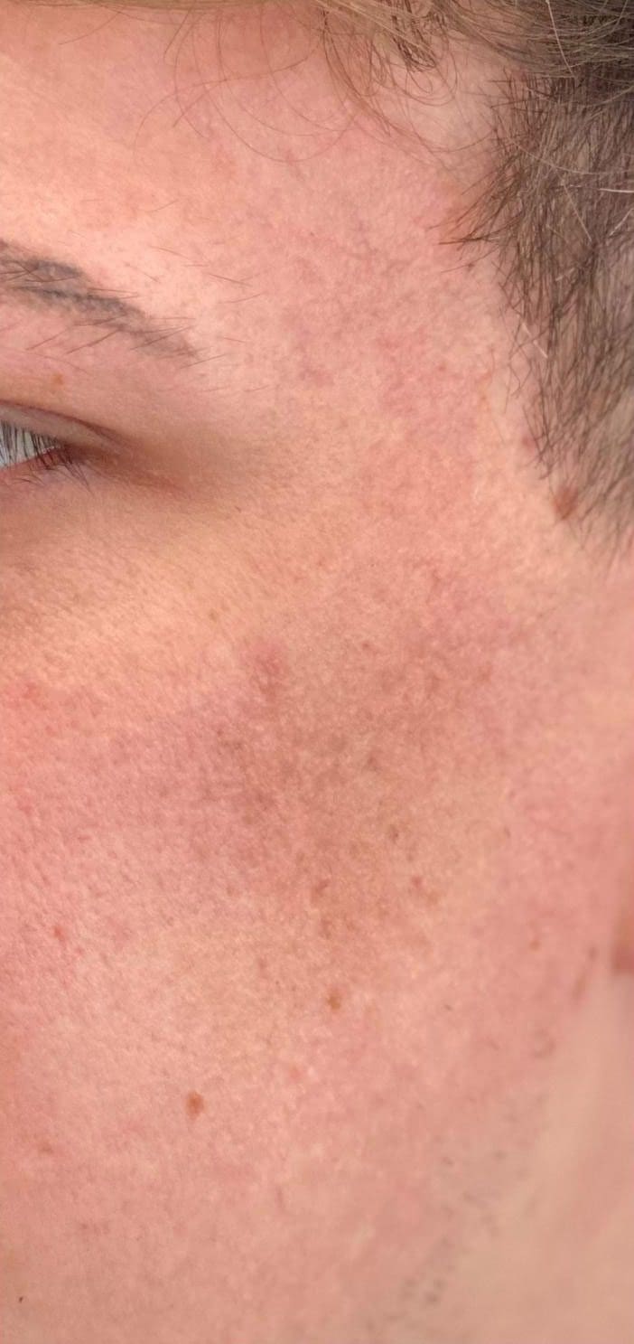 SecretPro - Dr Tatiana Lapa | Harley St Aesthetic Specialists